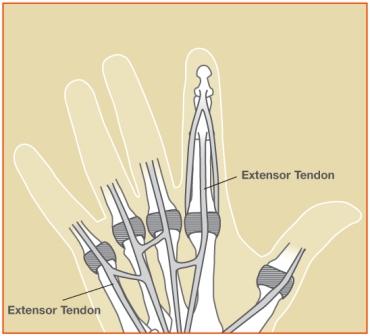 Extensor Tendon Injuries Orange County - Fountain Valley